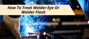 How To Treat Welder Eye Or Welder Flash | Plasma Cutter Center